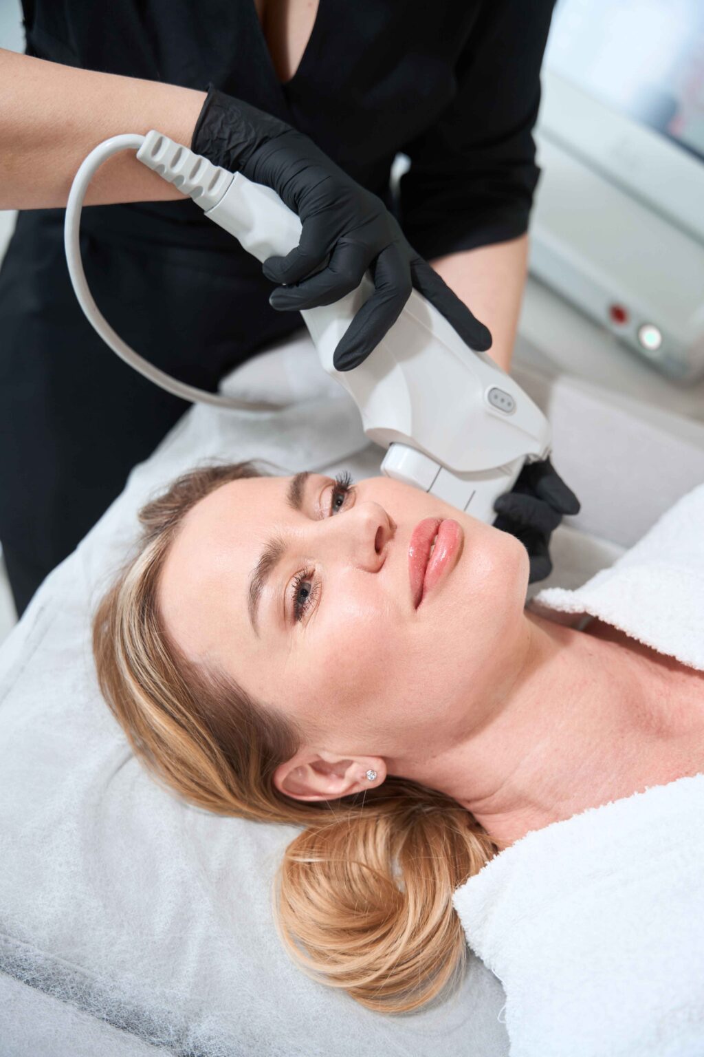 Fractional Radiofrequency Face Treatment | London Aesthetics Clinic